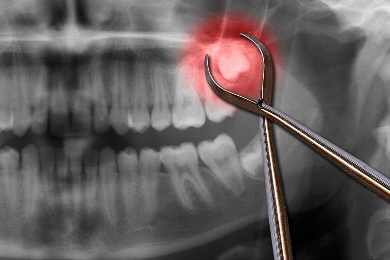 NoviSmile Dental Implant & Surgery Centers | Illinois